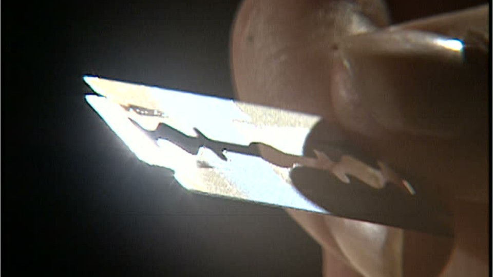 WARNING GRAPHIC: Boy’s face slashed with razor after fight at middle school