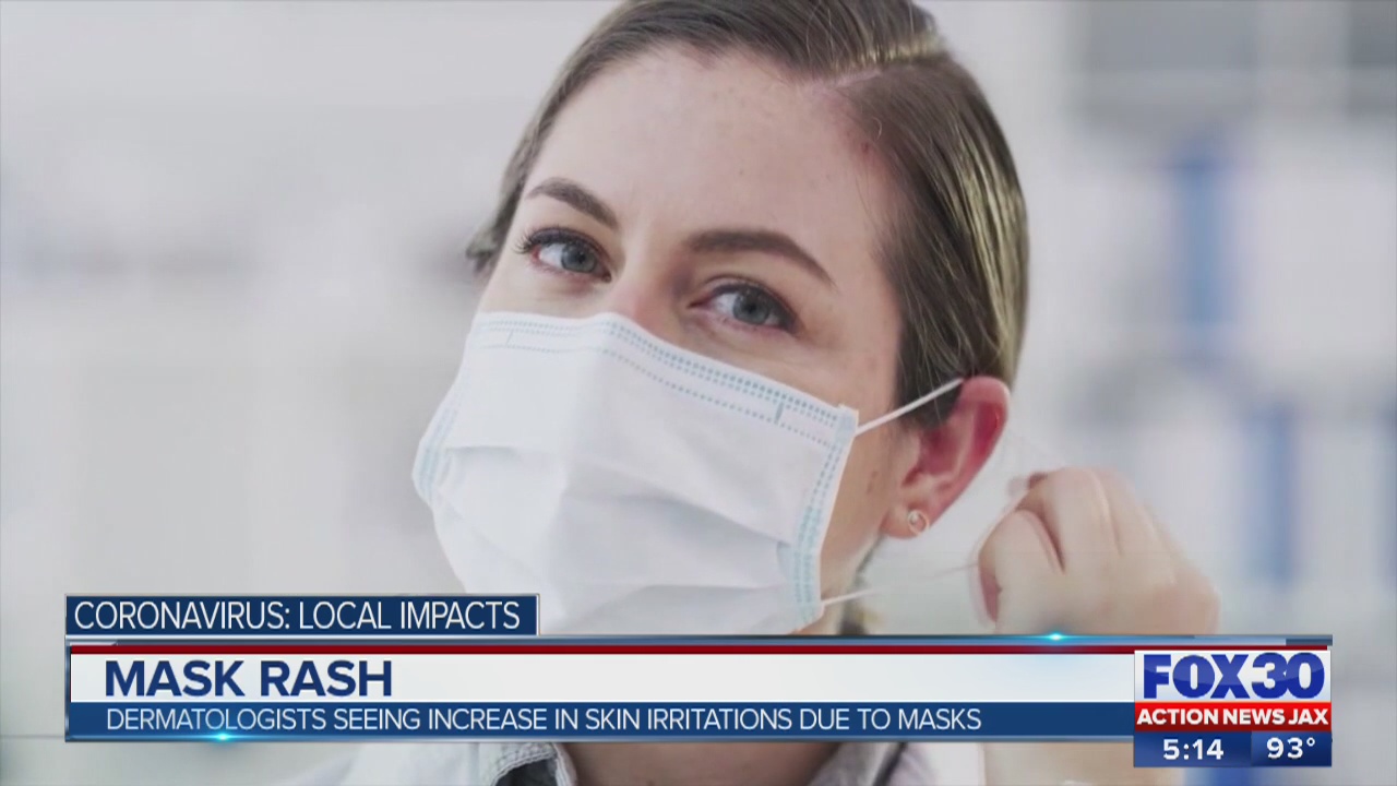 Jacksonville doctors see an increase in ‘mask rash’ caused by face ...