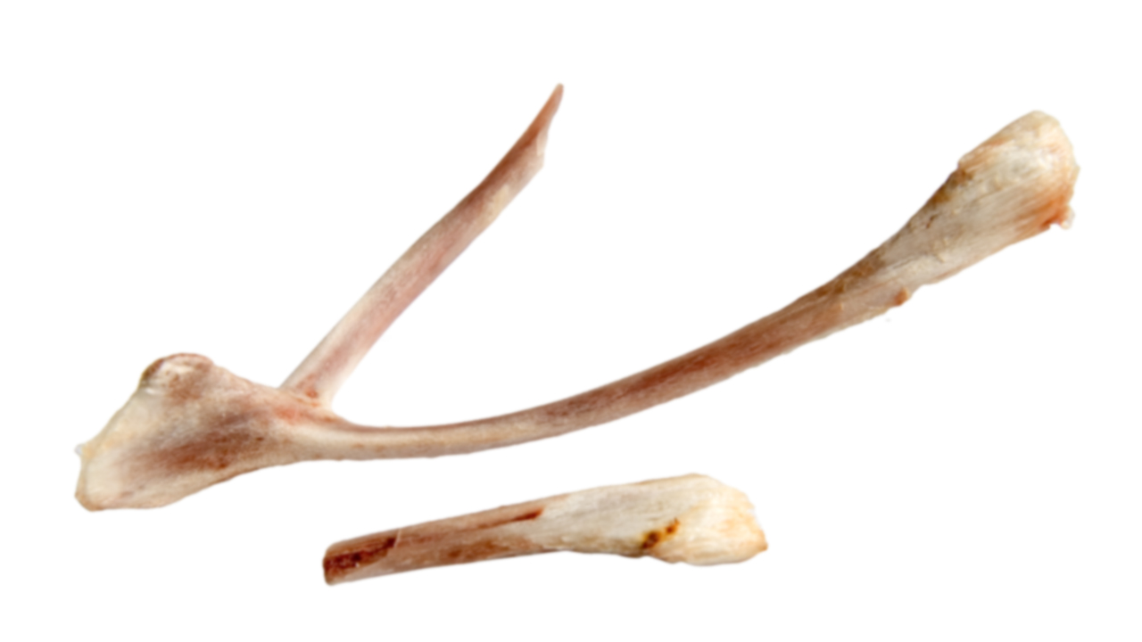 Young man dies of septic shock 2 weeks after choking on chicken bone