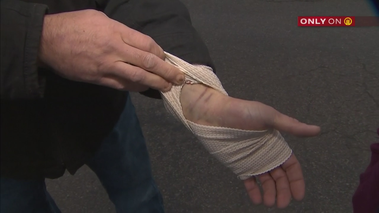 Man hurt in chain reaction crash talks about his injuries – WPXI