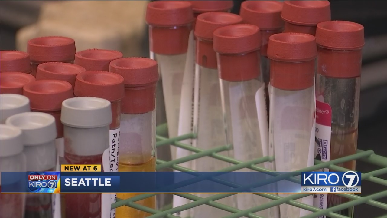 Blood test delays put King County Medical Examiner's Office at risk of ...