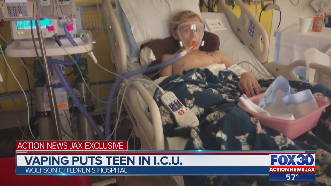 Clay County teen hospitalized due to lung damage from vaping