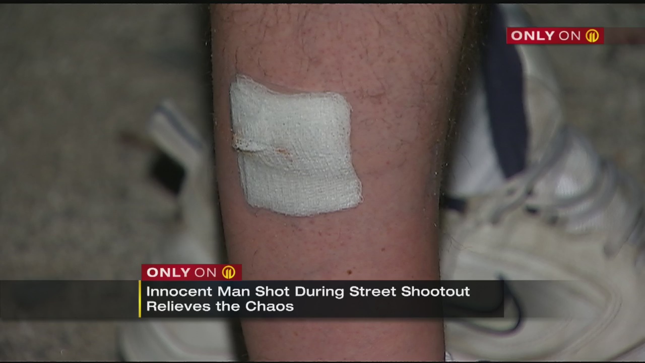 Bystander grazed by bullet during gunfire thankful his injury wasn't ...